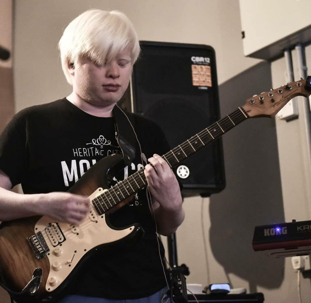 From Outcast To Indie Singer-Songwriter: The Albino Musician ...